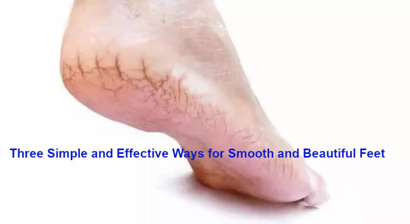 3 Simple and Effective Ways For Dry and Chapped Heel – Acupuncture ...